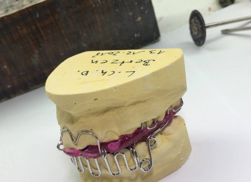 Jödicke – Fachlabor für Kieferorthopädie - Hansa Geräte | Jödicke ...