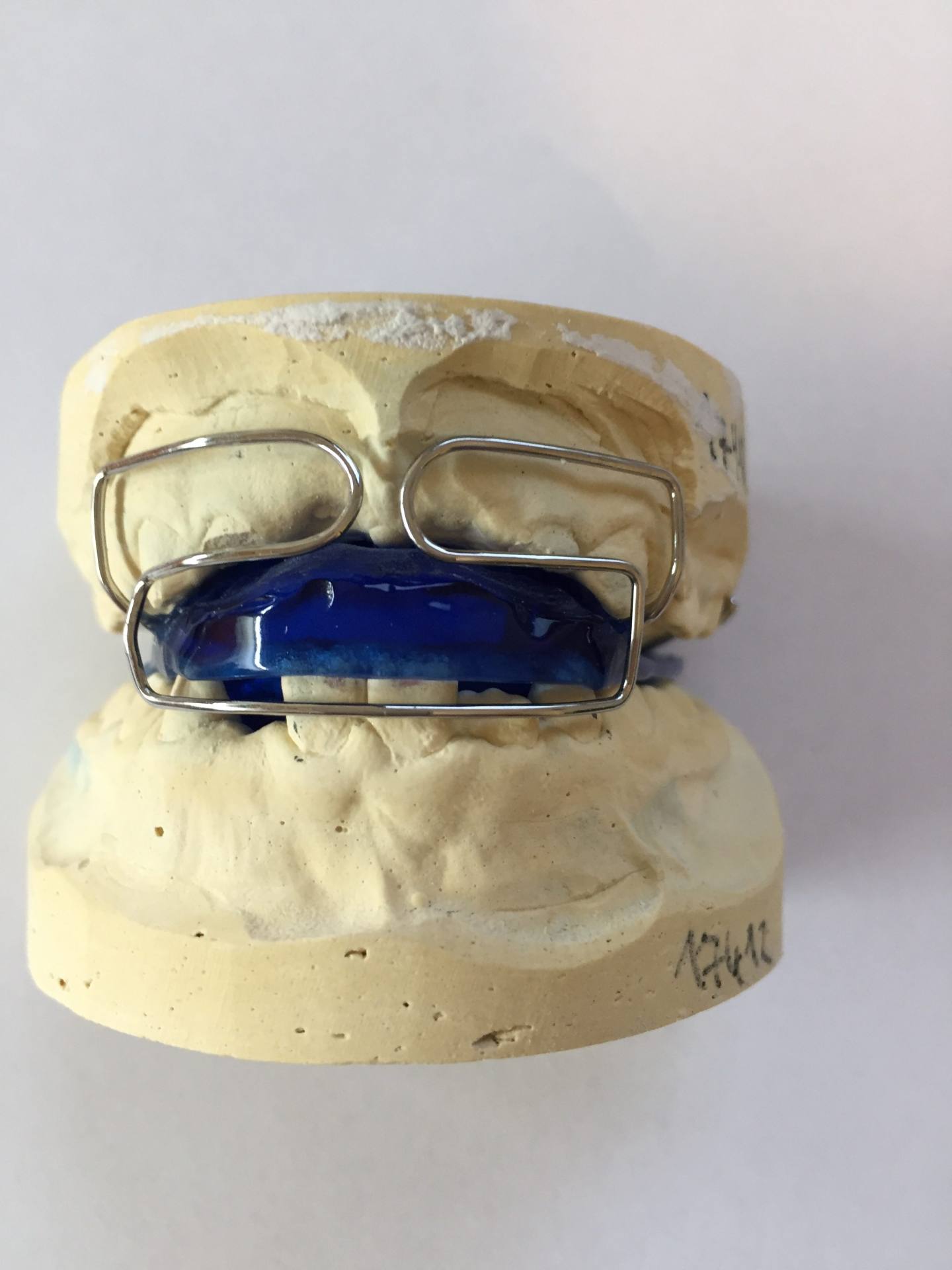 Aktivatoren - Der Aktivator | Jödicke - Fachlabor für Kieferorthopädie